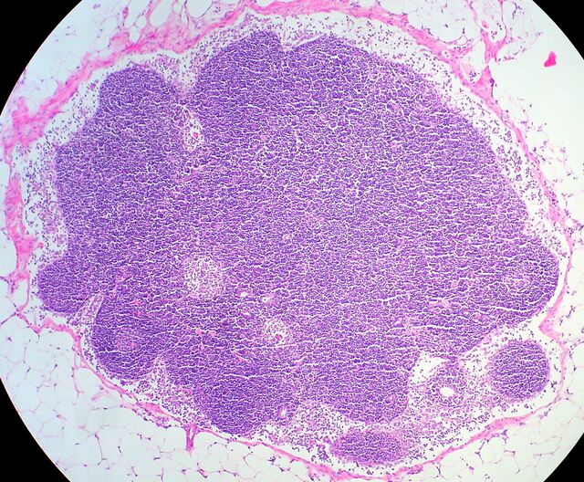 Datei:Normal Lymph Node.jpg – AnthroWiki