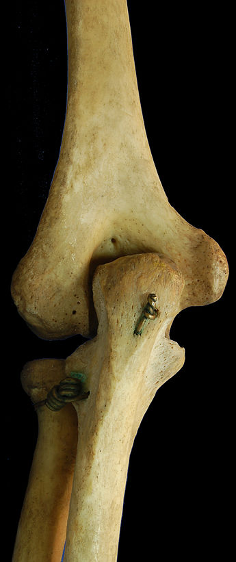 Oberarmknochen – AnthroWiki